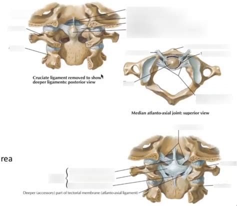 Atlantoaxial Joint Diagram Quizlet