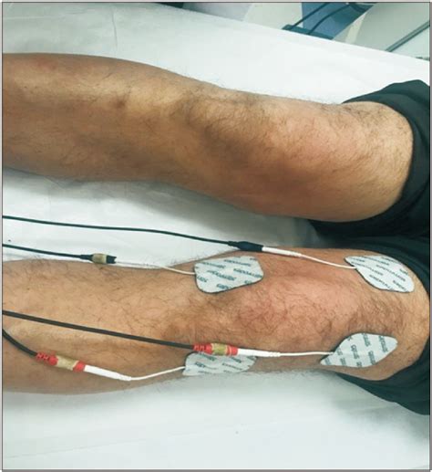 Comparison Of The Effects Of Transcutaneous Electrical Nerve Stimulation And Interferential