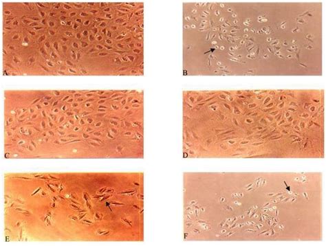 Potency Ascorbic Acid α Tocopherol And Its Combination On Structure Of
