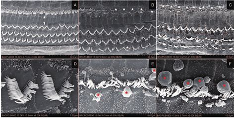 Damaged Cochlear Hair Cells