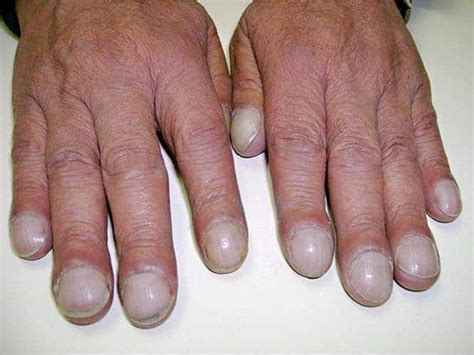 Was Sind Uhrglasnägel Und Wie Kann Ich Diese Behandeln Nageldesign