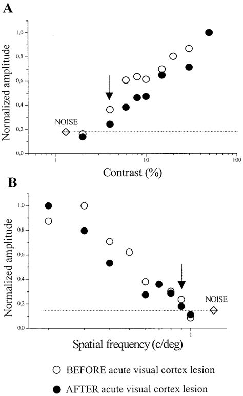 Effects Of Acute Visual Cortex Lesion On Contrast Threshold And Visual
