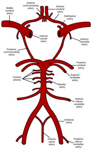 Stroke Artery Affected And Expected Presentation Case 7 Ptp V 2019