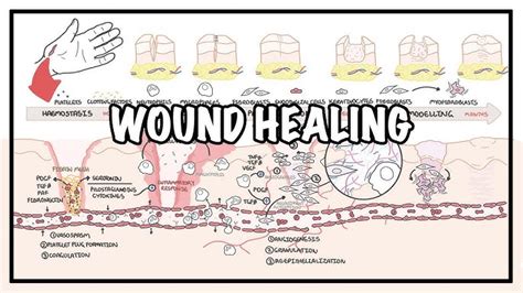 Wound Healing Skin