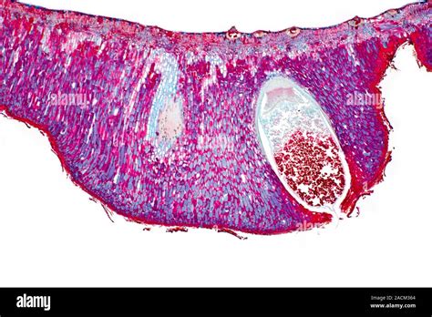 Pear Rust Fungus Light Micrograph Of A Section Through Tissue From A
