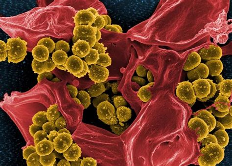 Mrsa Screening Test Dovemed