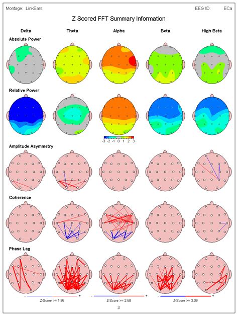 What Is A Brain Mapping Test At Jade Haylen Blog