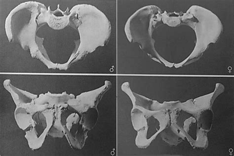 Estimate The Biological Sex Of A Human Skeleton All Things Aafs