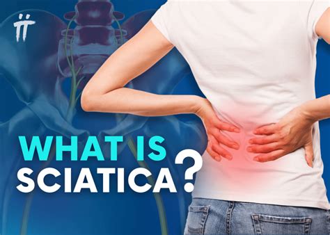 What Is Sciatica What Is Good For Sciatica Pain Turanandturan