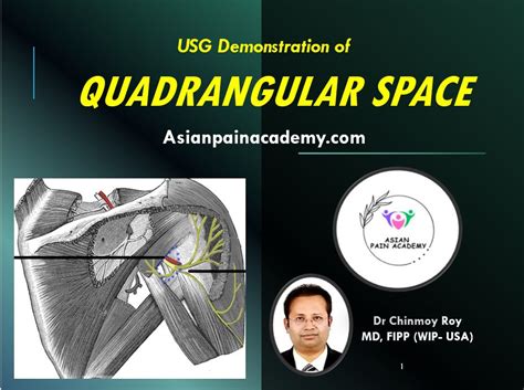 Quadrangular Space Anatomy