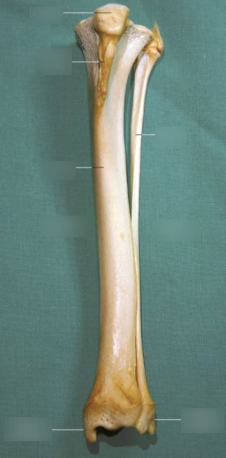 AS 512 Unit 2 Tibia And Fibula Diagram Appendicular Skeleton Diagram