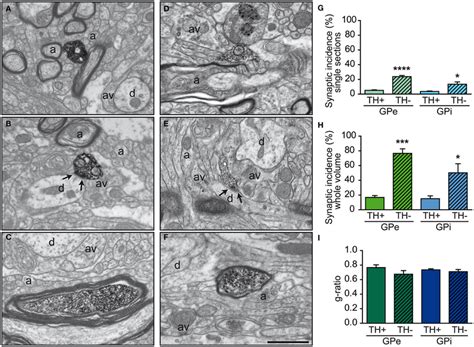 Examples Of Th Axon Varicosities And Myelinated Axons In The Gpe Ac
