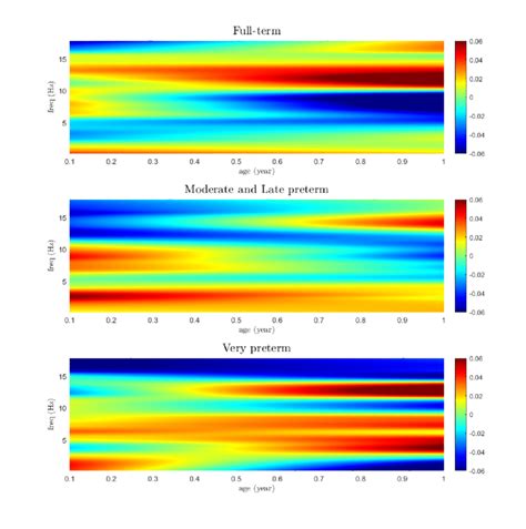 Local Connectivity Pattern For The Three Groups Of Infants Full Term