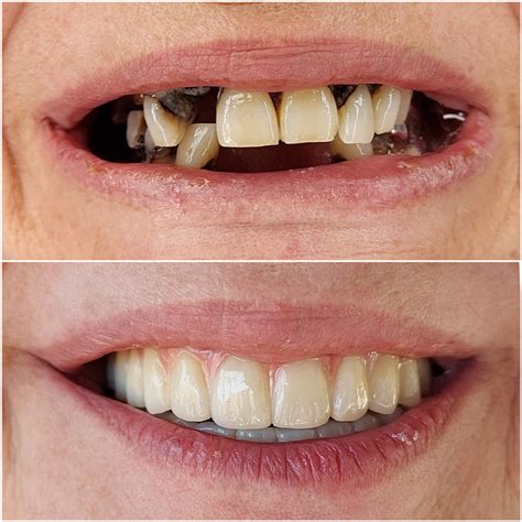 Patient Treatment Prof Dr Stefan Ihde