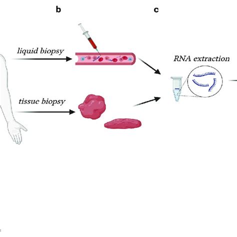 Presence Of Rna Molecules In Liquid And Tissue Biopsies A Lncrna