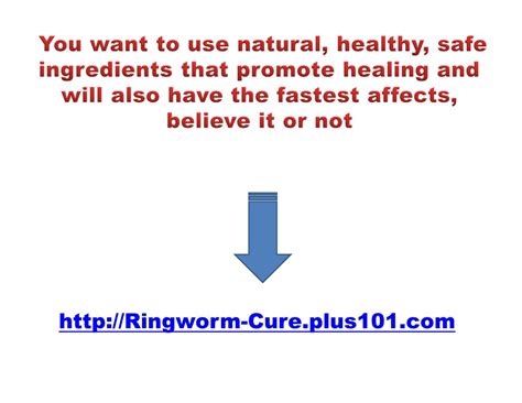Ppt Iodine For Ringworm Best Ointment For Ringworm Where Do You Get Ringworm How To Treat