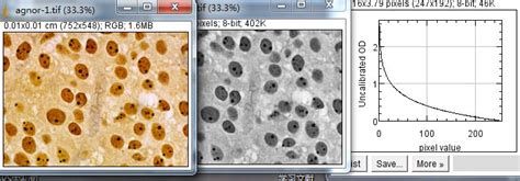 Imagej分析免疫组化图片（附imagej的多种实用技巧） 照片