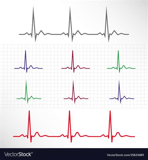 Elements And Lines Of Normal Ecg Royalty Free Vector Image