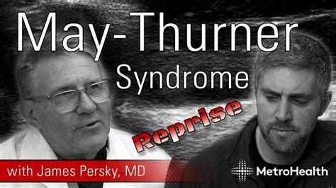 May Thurner Syndrome Reprise W James Persky Md Matthew Tabbut Md