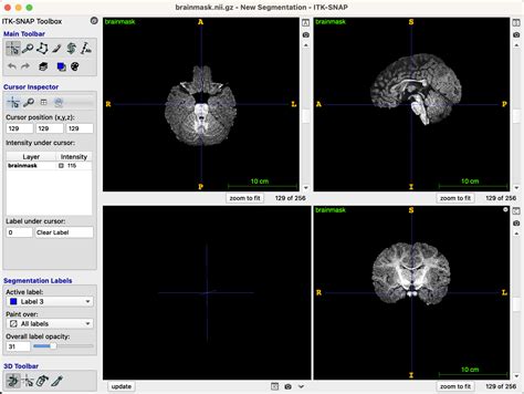 Itk Snap Tutorial 2 The Itk Snap Gui — Andys Brain Book 1 0 Documentation