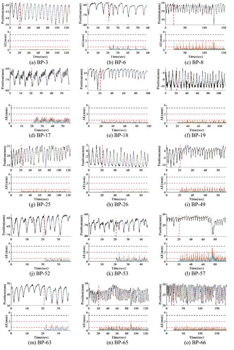 Real Time Respiratory Motion Prediction Using Photonic Reservoir