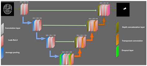 Improved Brain Tumor Segmentation In Mr Images With A Modified U Net