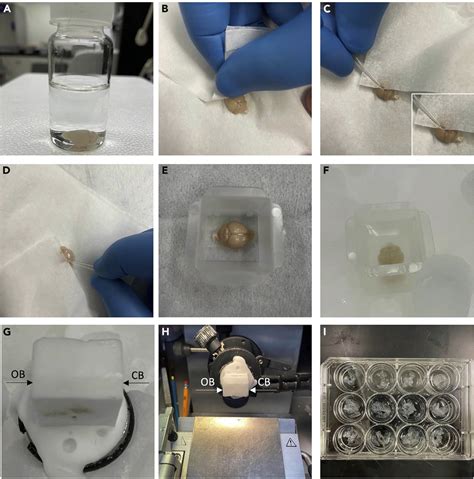 Brain Saturation In Sucrose And Oct Embedding A Brain At The