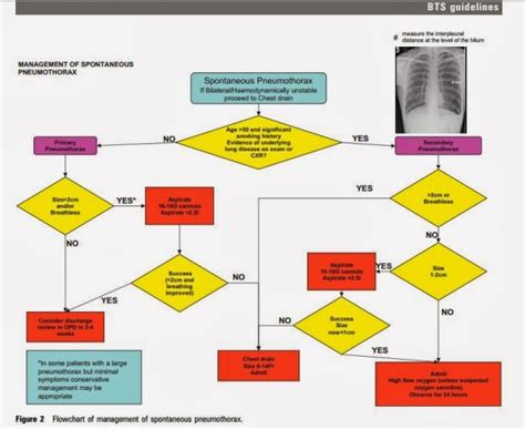 Cme Pneumothorax Management Charlies Ed