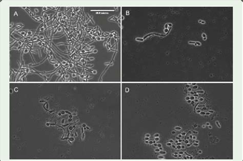 Yeast Growth In Nutrient Media Supplemented With Individual Bacterial