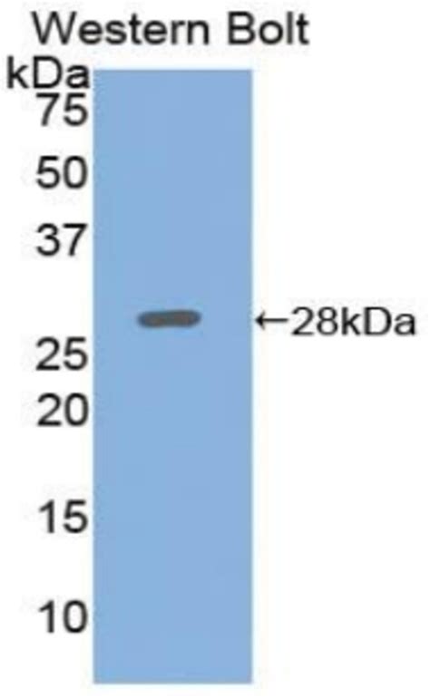 Invitrogen Adenylate Cyclase 5 Polyclonal Antibody Invitrogen 100 μl