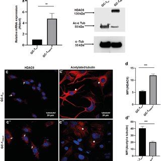Upregulation Of Profilin On HDAC Overexpression In Mouse GC Cells And Its Putative Role In