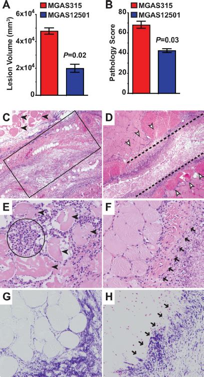 Asymptomatic Carrier Strain Mgas12501 Is Significantly Less Virulent Than Download Scientific