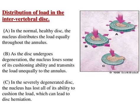 Pivd Ppt Pptx Death Injury Or Military Conflict Sensitive Topics
