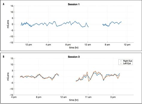Iop Monitoring Via A Smartphone Glaucoma Today