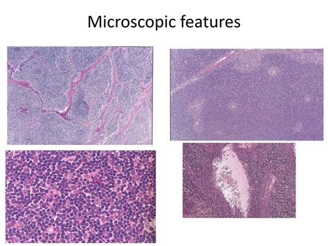 Pathology Of Thymus Pptx