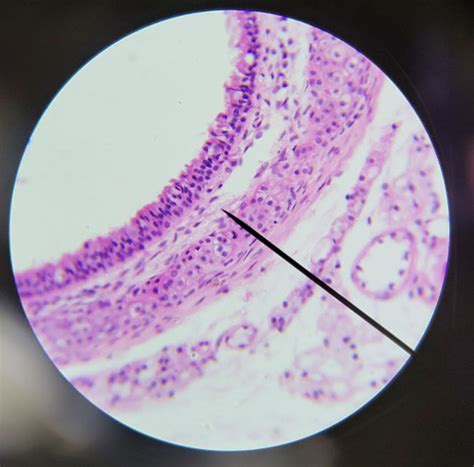 Epithelial Tissues Matching 🧑‍🔬🔬 Flashcards Quizlet