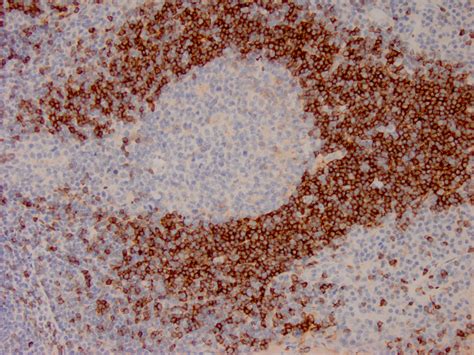 Igd Antibody Ivd Antibody For Ihc Zeta Corporation