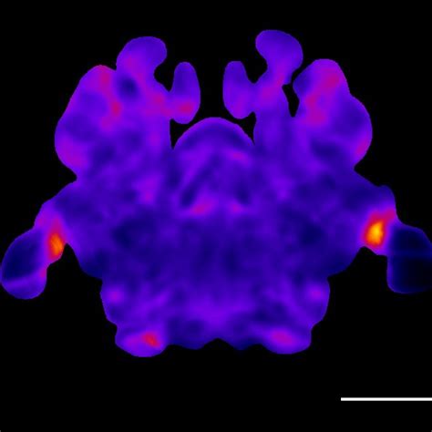 Inter Type Deformation Based Morphometry From Left To Right Central