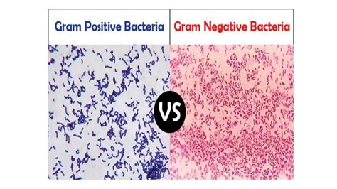 Gram Staining Technique For Bacterial Identification Ppt
