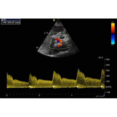 Ge Vivid E9 Ultrasound Machine Medpick