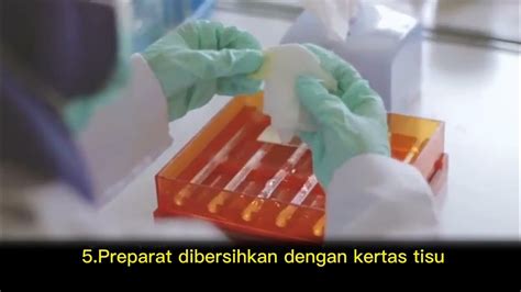 Pewarnaan Imunohistokimia Fibronektin Metode Parafin Youtube