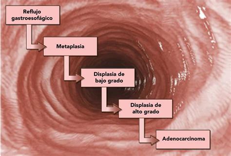 Ebook Gastroenterología V3pi2023 By Qxmedic Issuu