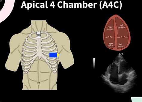 Introduction To Cardiac Pocus The Scope