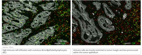 Unlocking The Secrets Of Spatial Biology A Journey Towards Understanding And Improving