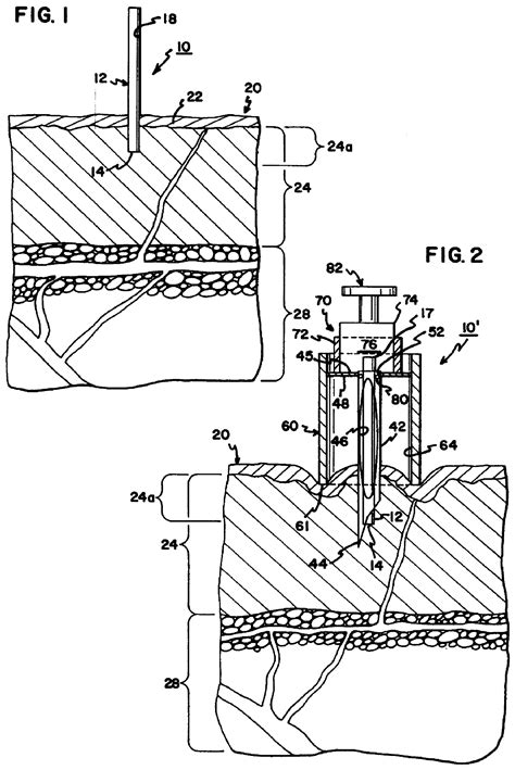 Interstitial Fluid Collection And Constituent Measurement Eureka Patsnap