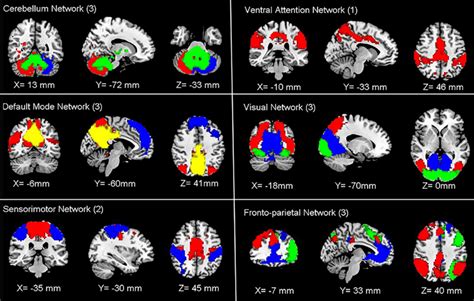 functional associated resting state networks rsns the spatial maps