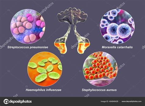 Streptococcus Pneumoniae Structure