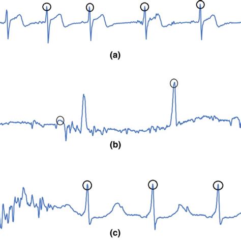 Rr Interval Signal Quality Of A Heart Rate Monitor And An Ecg Holter At Rest And During Exercise