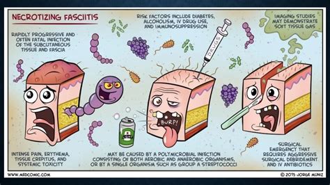 Necrotizing Soft Tissue Infection Vs Cellulitis Pptx