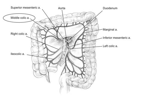 Middle Colic Artery